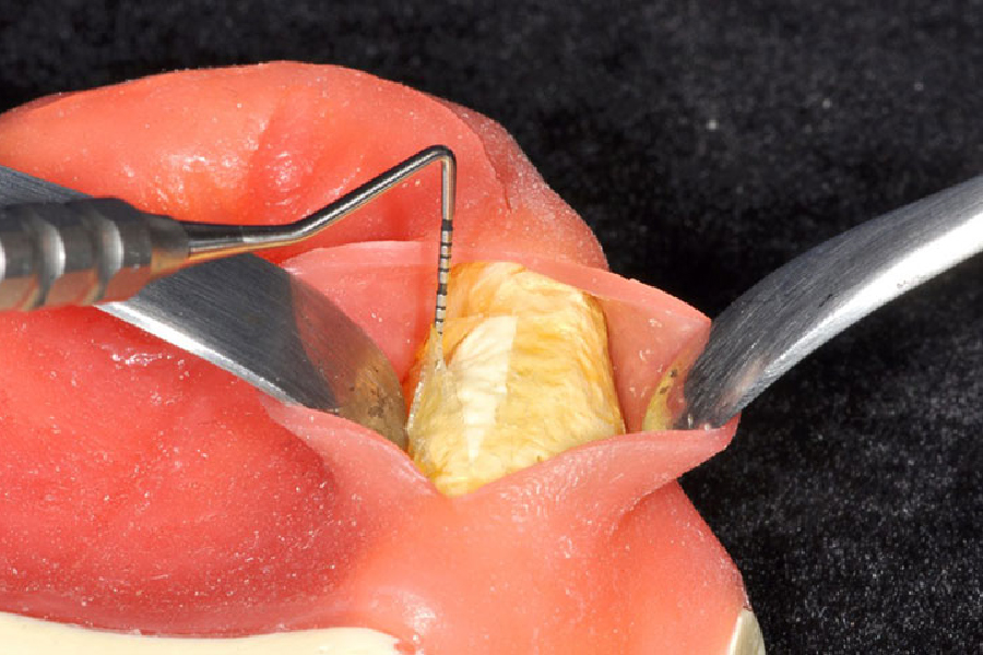 Periosteum - BONEMODELS S.L.U.